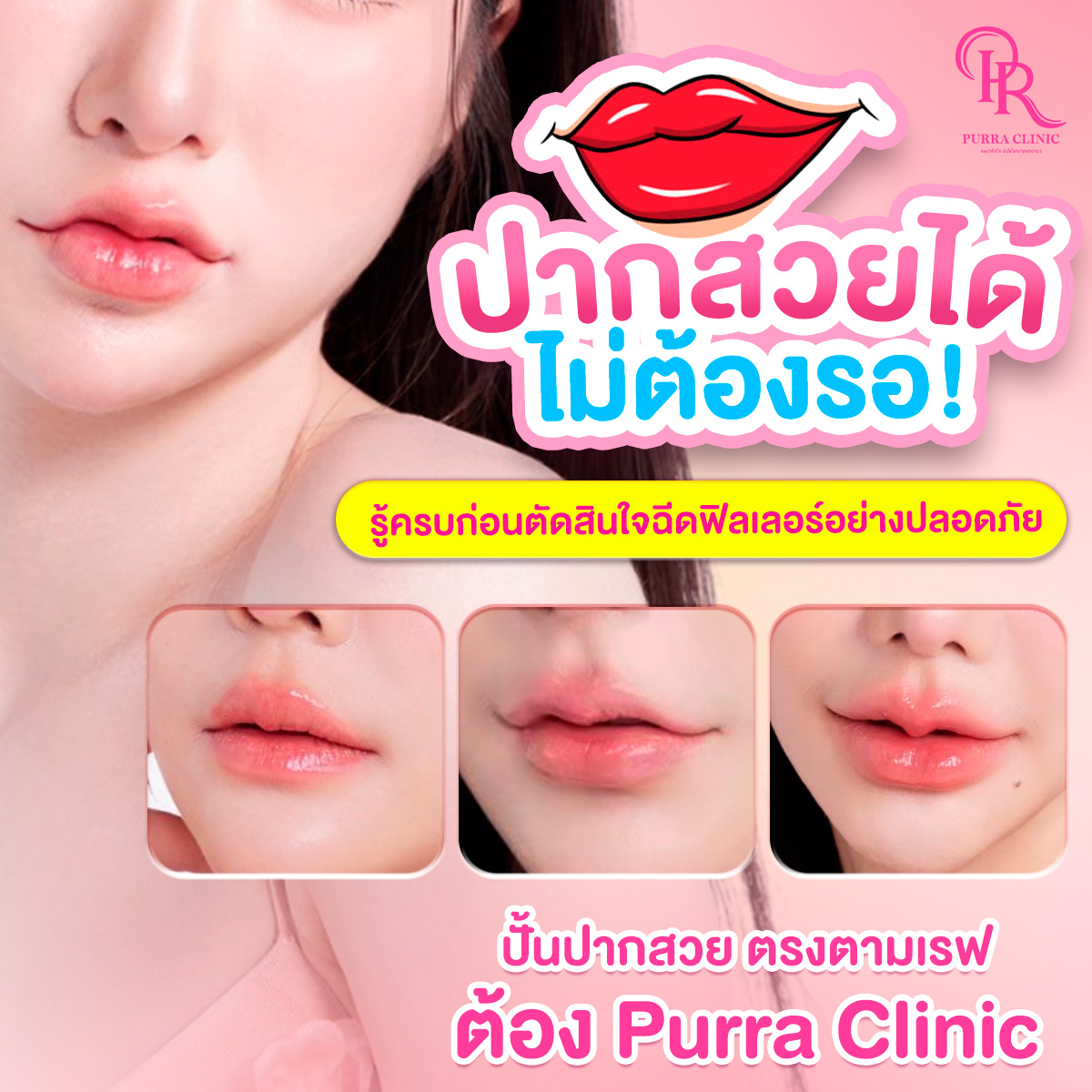 โปรแกรมฉีดฟิลเลอร์ปาก รู้ครบก่อนตัดสินใจฉีดฟิลเลอร์อย่างปลอดภัย - Purra ...